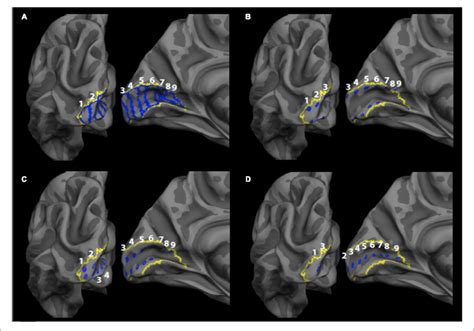 Primary Visual Cortex V1 Regions Of Interest ROIs The Label Download Scientific Diagram