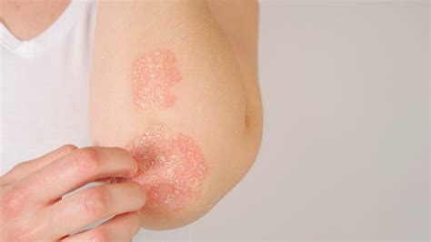 Klassische Dermatologie Dermamedizin