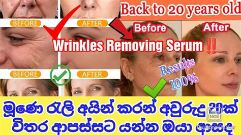 රැලි වැටිලා තියෙන ඔයාගෙ මූණ ඇස් බෙල්ල ආයෙත් කලින් වගේ කරන් අවුරුදු 20ක් විතර තරුණ වෙන්න ආසද