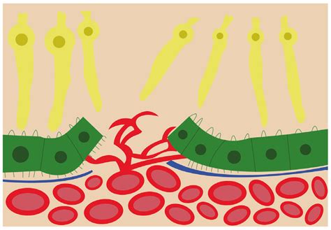 Schematic View Of The Choroidal Neovascularization Process The New Download Scientific Diagram