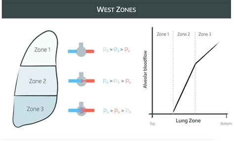 Dead Space And West Zones