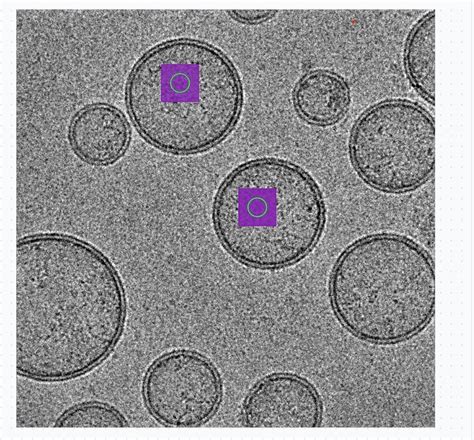 Cryo Em Micrograph Vesicle Size Sorting Image Analysis Image Sc Forum