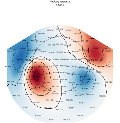 Plotting Topographic Maps Of Evoked Data — Mne 180 Documentation