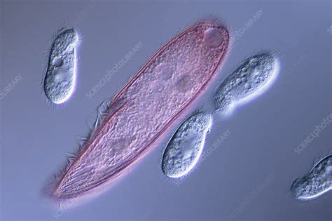 Blepharisma Protozoan Light Micrograph Stock Image C051 1202 Science Photo Library
