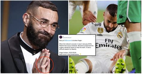 Karim Benzema Whats The Story Behind Real Madrid Stars Injured Finger