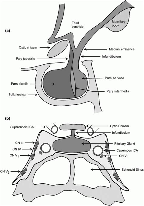 Transsphenoidal Hypophysectomy Anesthesia Key