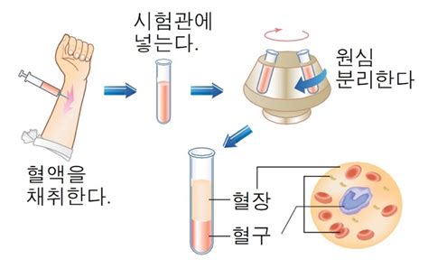 혈액검사 혈액검사로 알 수 있는 질병 혈액검사 항목 혈액의 기본 개념 네이버 블로그