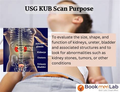 Usg Kub Test Price Purpose Procedure Report And Risks