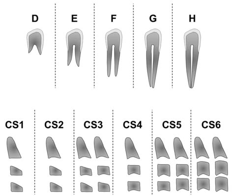 Dental Maturational Stages And Cvm Stages Dental Maturational Stages