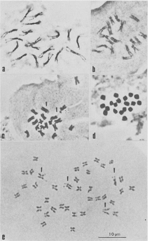 Somatic Chromosomes At Prophase And Metaphase Of Sugar Beet × 1900 A