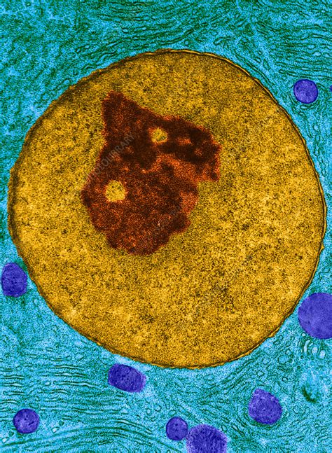 Pancreatic Acinar Cell Tem Stock Image C0282068 Science Photo