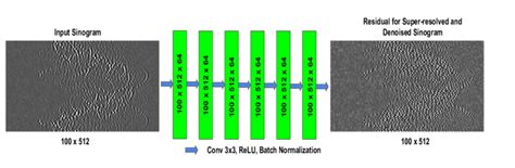 The Proposed Sinogram Super Resolution And Denoising Convolutional