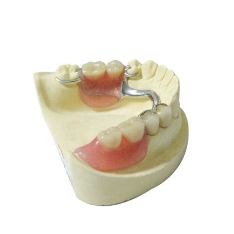 Healthy Materials Denture Dental Lab Removable Partial Dentures Custom Made