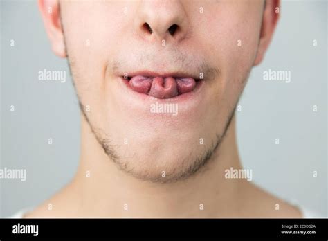 Close Up Of A Young Man Folding His Tongue In A Rare Tri Fold Clover
