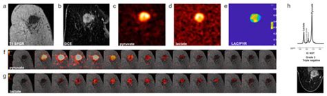 Diagnostics Free Full Text Hyperpolarized Carbon 13 Mri In Breast Cancer