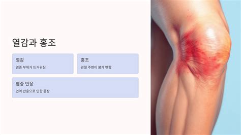 류마티스 관절염 초기증상 검사방법 치료법 류마티스 관절염 증상에 좋은 음식