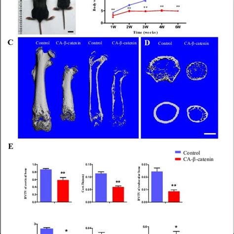 Micrographs Of The Proximal Tibial Growth Plate Of A Control And B