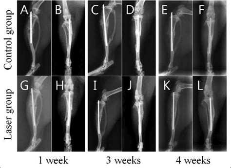 Representative Radiological Images Of Tibia Bone After Artificial Download Scientific Diagram