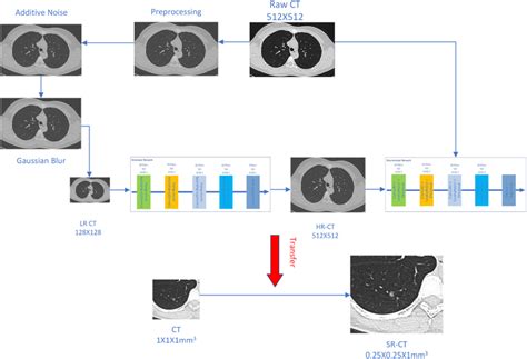 Deep Learning Based 3d Super Resolution Ct Radiomics Model Predict The Possibility Of The