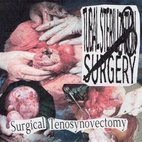 Surgical Tenosynovectomy Tubal Sterilization Surgery