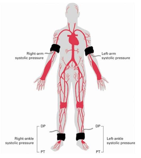 Ankle Brachial Index Worksheet — Db