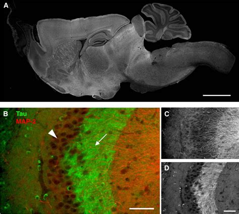 Ectopic Expression Induces Abnormal Somatodendritic Distribution Of Tau In The Mouse Brain