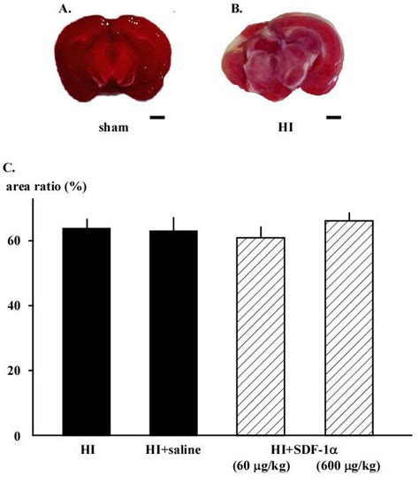 Rotarod Test Results Demonstrating That Motor Coordination Was