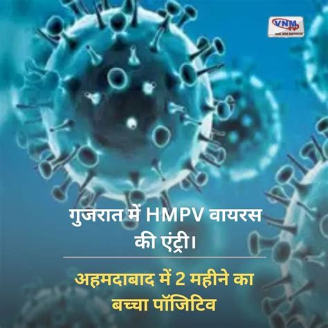गुजरात में ह्यूमन मेटान्यूमोवायरस Hmpv का पहला मामला दर्ज किया गया है अहमदाबाद में 2 महीने का