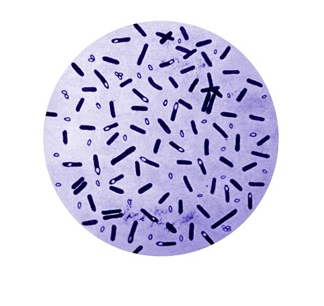 Clostridium botulinum это