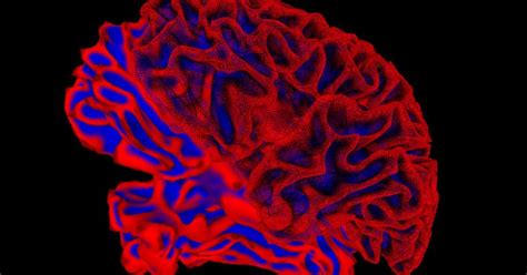 Meet The Neuralink Cofounder Who Left And Started A Competitor Thats Now Rapidly Catching Up