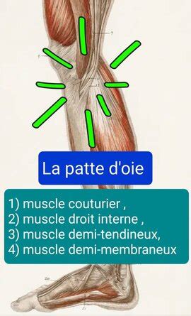 Tendinite de la patte doie Santé Médecine