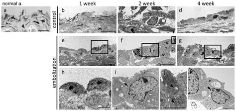 Transmission Electron Microscopy Of A Normal Artery Ek In The