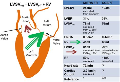 Echocardiography Aortic Stenosis