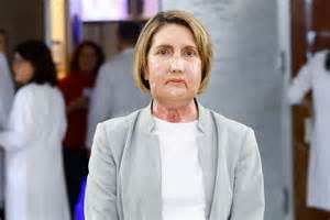 Primer Trasplante De Cara Del Mundo Con Una Donante Que Recibió La