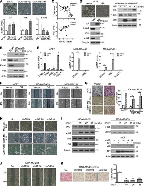 Gr Induces Emt And Cell Migration A Morphological Differences Of