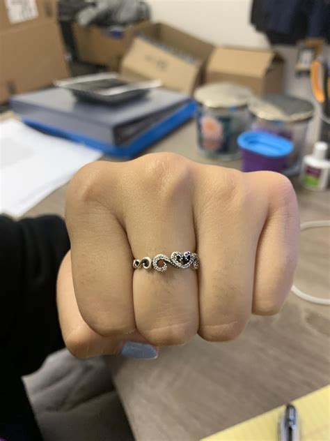 Dislocated Metacarpal Does Anyone Have Experience With This Its