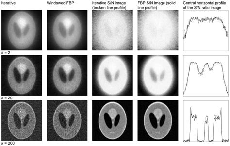 Model Based Filtered Backprojection Algorithm A Tutorial Pmc