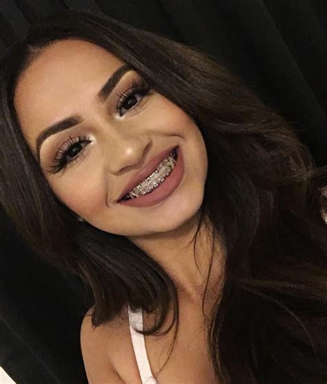 Pinterest Claudiaaem ☾♡ Teeth Braces Cute Braces Braces Colors
