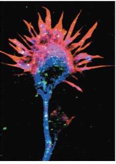 Ch 17 Pt2 Neural Crest Cells And Axonal Specificity Flashcards Quizlet