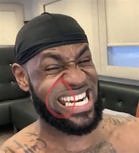 Lebron Is Missing Teeth 🧐 R Lakers