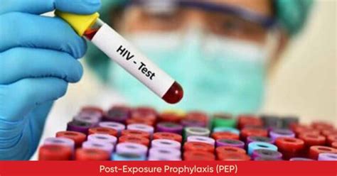 Post Exposure Prophylaxis Pep In Hiv