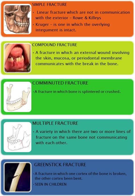 Mandible Fracture Treatment