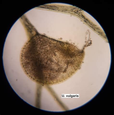 Utricularia Bladderwort Traps Under The Microscope Rcarnivorousplants