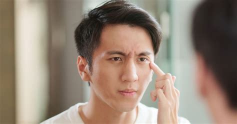 Top 3 Causes Of Facial Hyperpigmentation In Men You Should Know Doctor Network