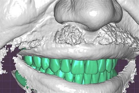 37 Facts About Dental 3D Face Scanner Facts Net