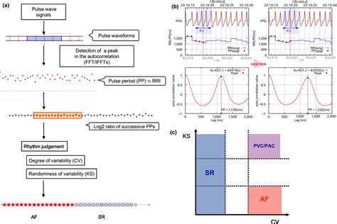 A Diagnostic Algorithm The Logarithmic Ratio Of The Successive Pulse