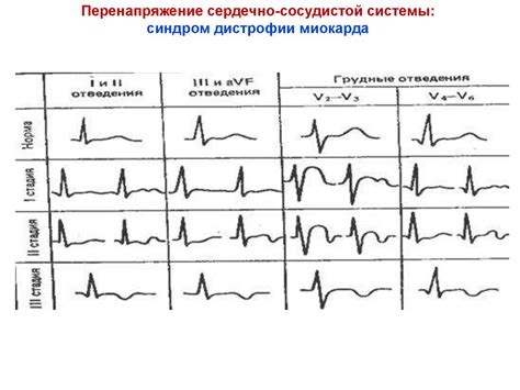 Перетренированность и перенапряжение у спортсменов - презентация онлайн