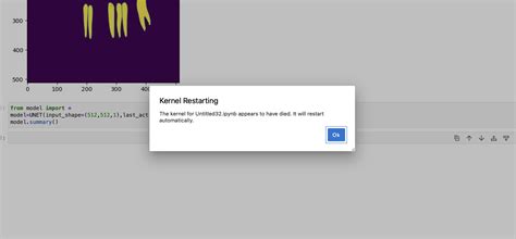 Cannot Import Error Issue SerdarHelli Segmentation Of Teeth In Panoramic X Ray Image