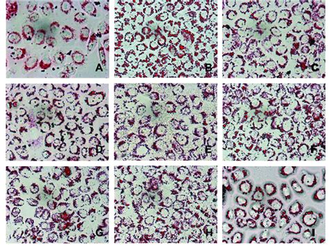 Oil Red O Staining Of The Hepg Cells In Each Group A Normal Group