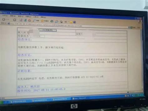 南昌市第三医院成功实施全省公立医院首例乳腺良性肿瘤微波消融术